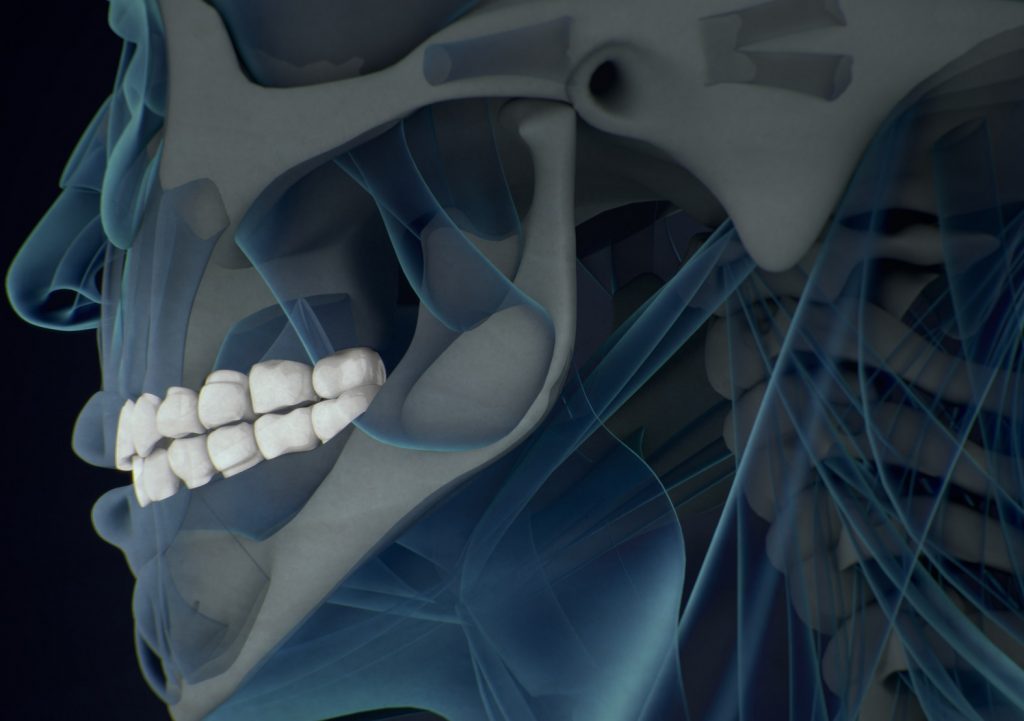 Things You Should Know About Jawbone Grafting | Santa Rosa, CA